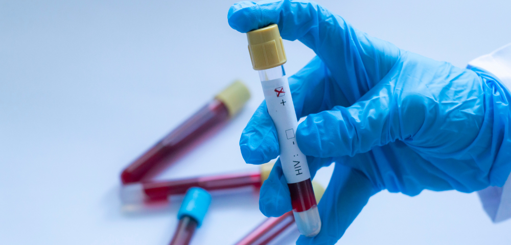 HIV Treatment Could Allow People To Stop Taking Medication Daily